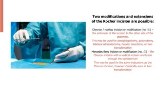 Kocher's innovation by lezan ibrahim and omed mohamad | PDF