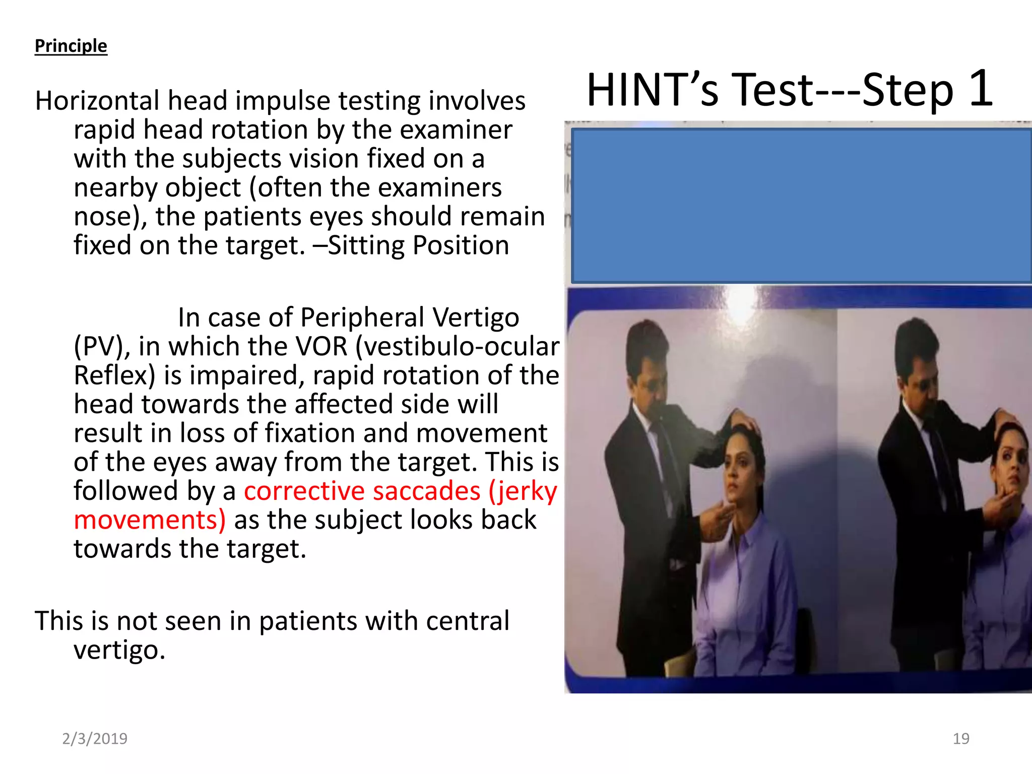 APPROACH TO VERTIGO | PPTX