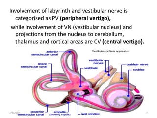 APPROACH TO VERTIGO | PPTX