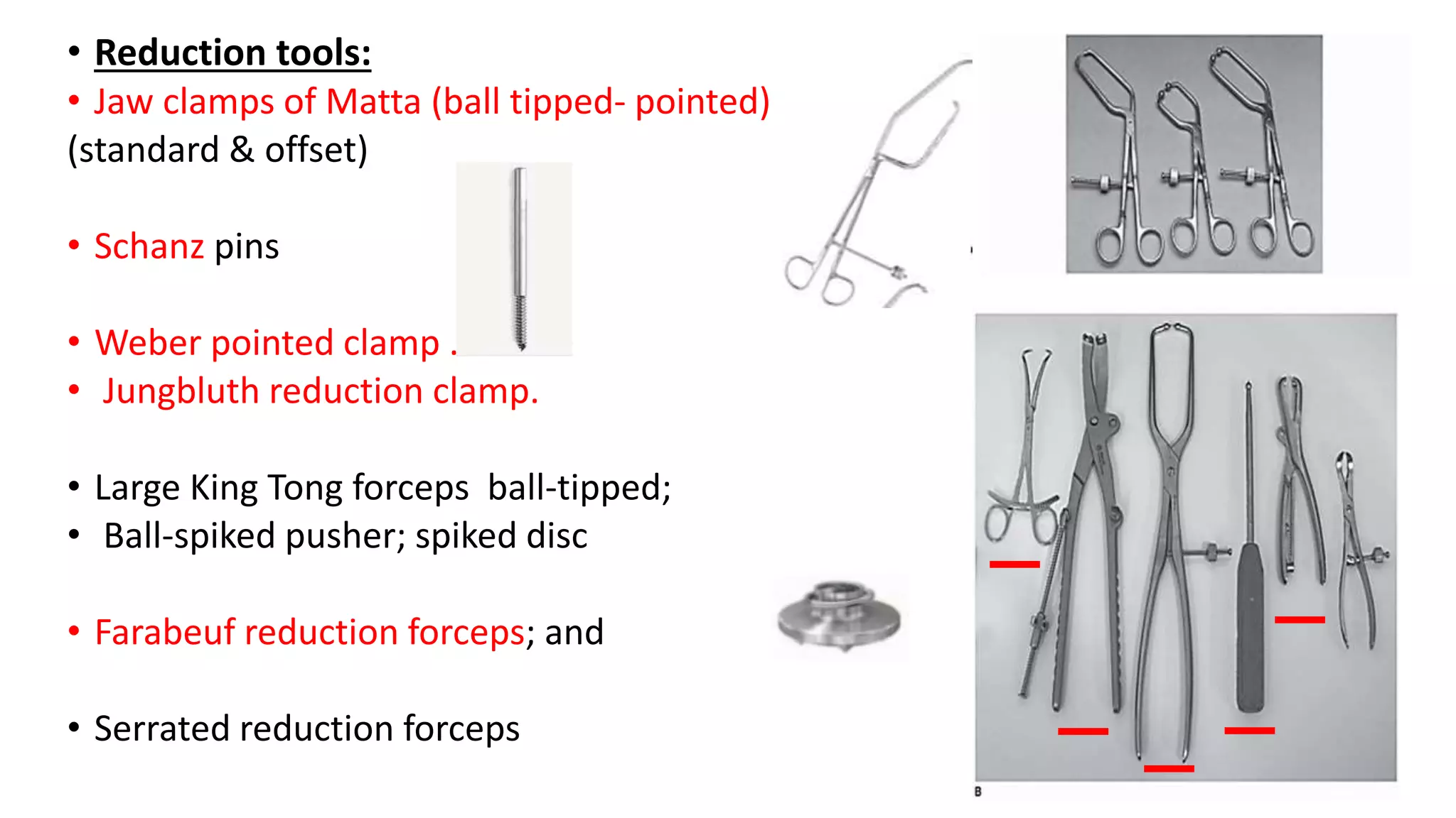 Kocher-Langenbeck acetabular approach | PPTX