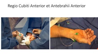 Anatomia membrului superior - recapitulare | PPTX