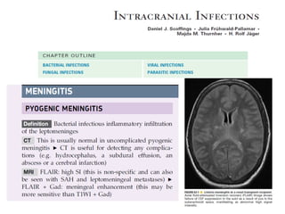 Brain infection | PPT | Brain and Nervous System Disorders | Diseases ...