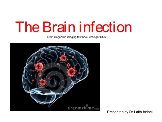 Brain infection