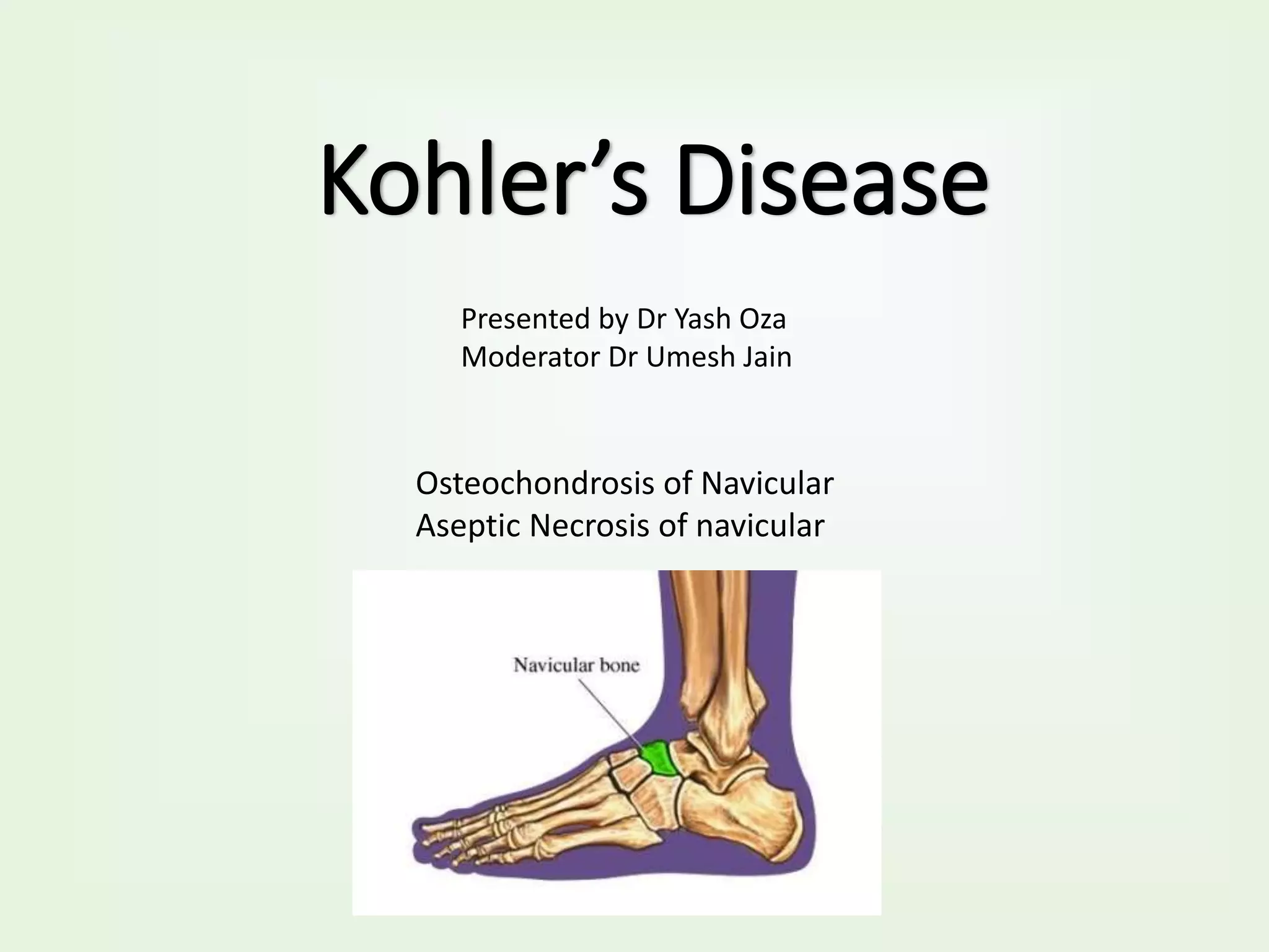 Kohler's disease | PPTX