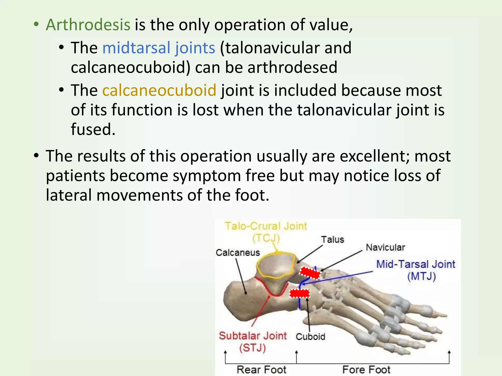 Kohler's disease | PPTX