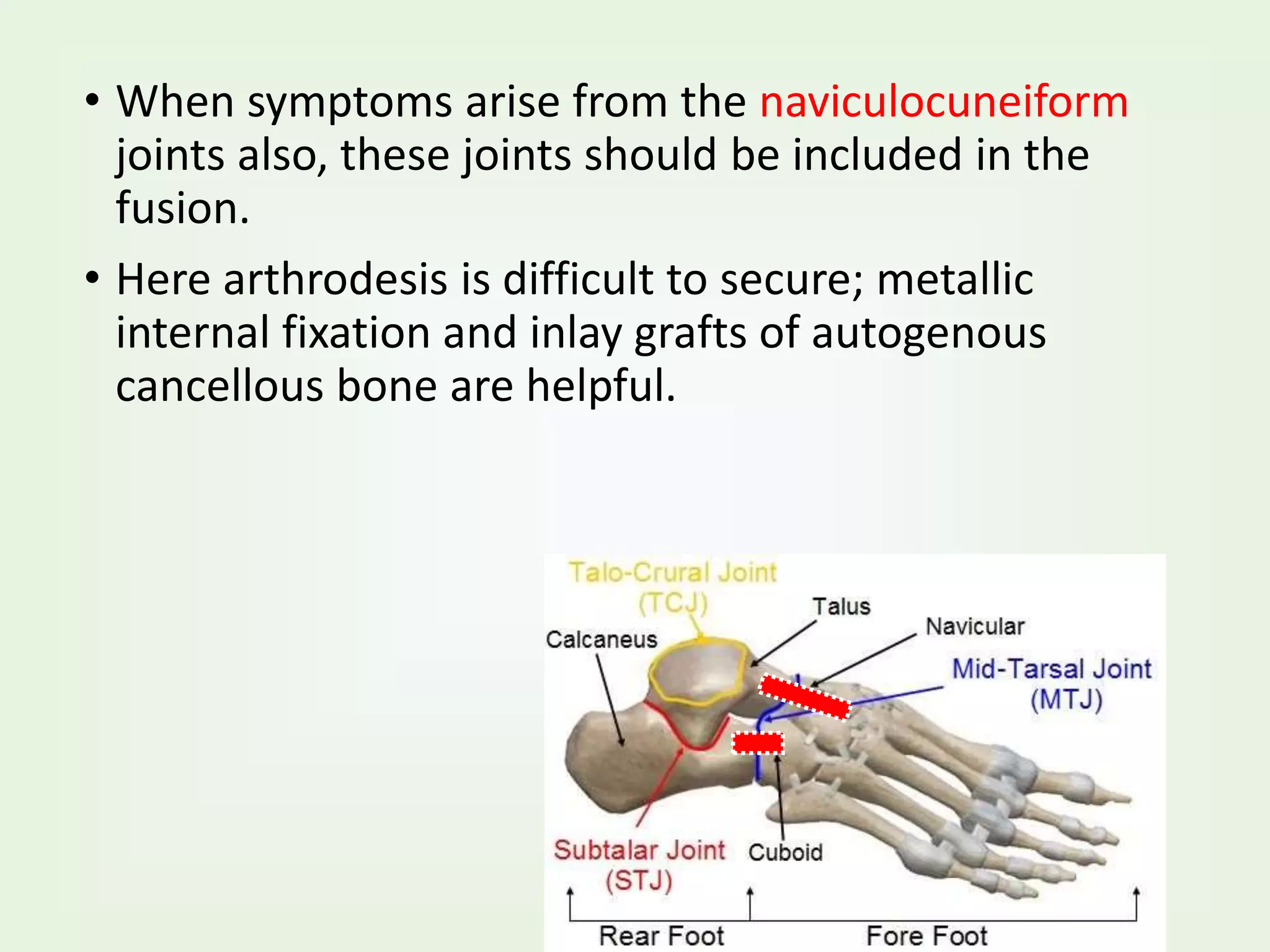 Kohler's disease | PPTX