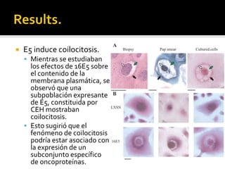 Koilocytosis. a cooperative interaction between the human ...