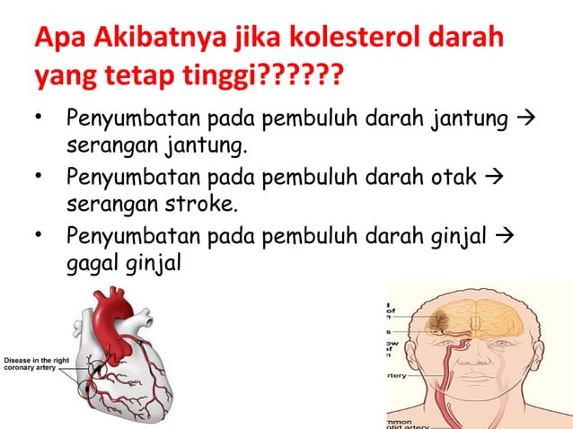 KOLESTEROL | PPT