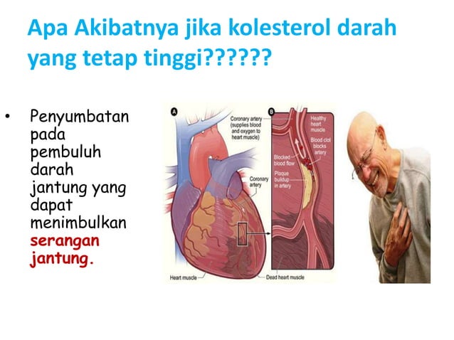 Kolesterol_Slide.ppt