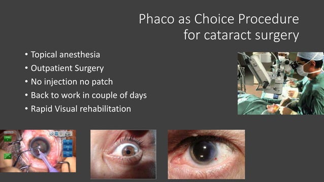 Advances in Manual Small Incision Cataract Surgery | PPTX | Eye and ...