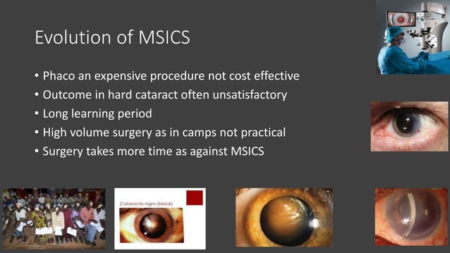 Advances in Manual Small Incision Cataract Surgery | PPTX | Eye and ...