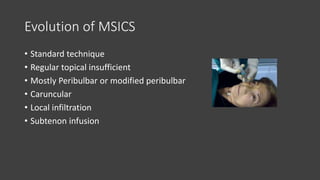 Advances in Manual Small Incision Cataract Surgery | PPTX