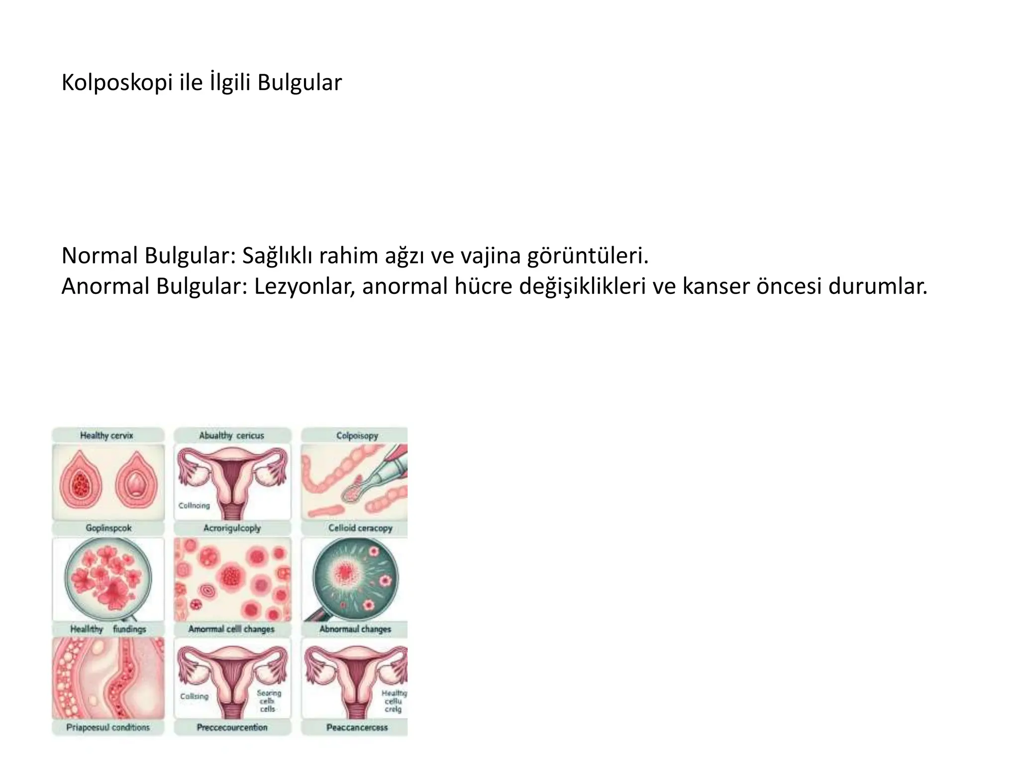 Kolposkopi Nedir Neden ve Nasıl Yapılır.pptx
