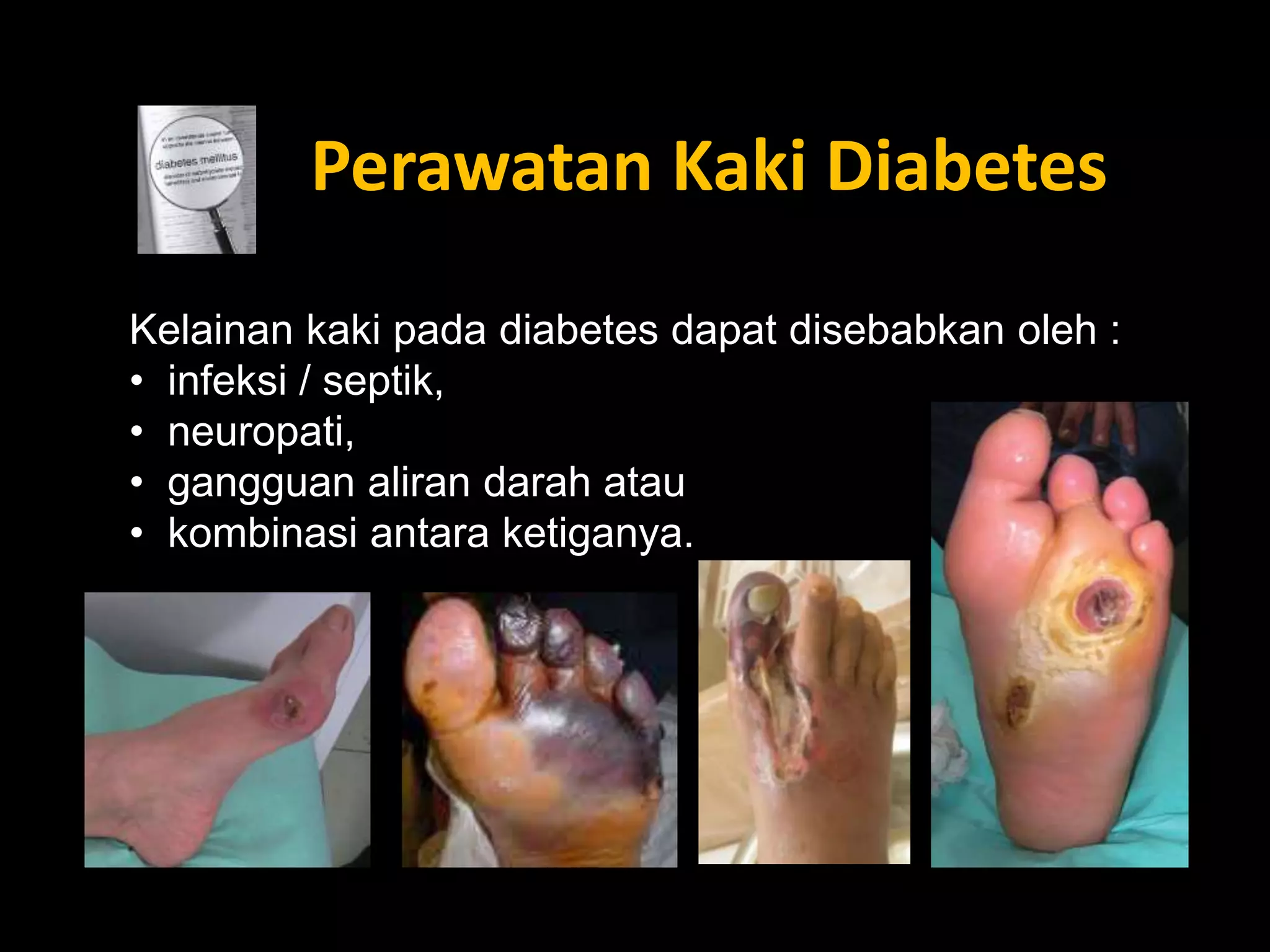 Komplikasi dm by dr gabriella | PPTX