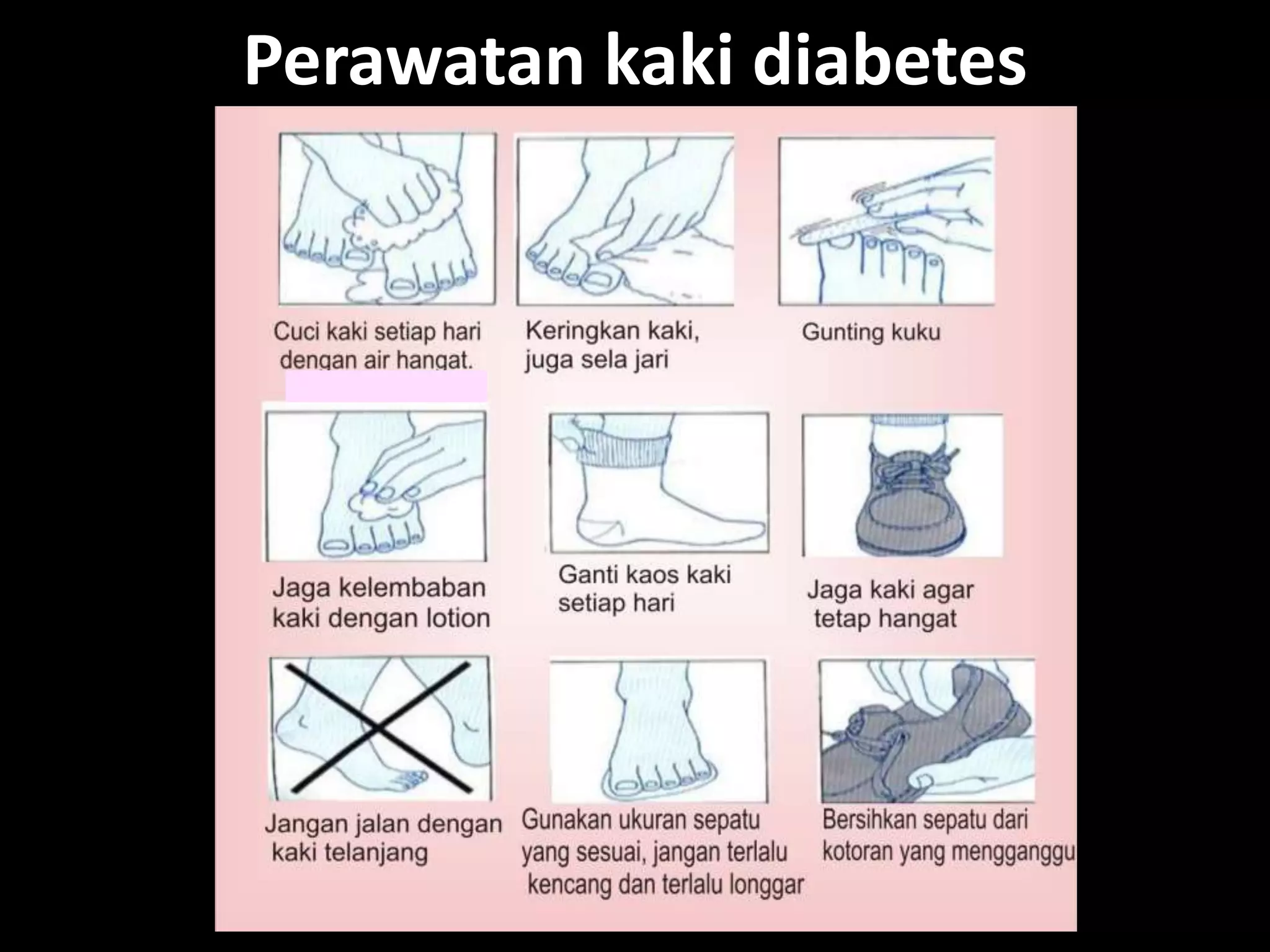 Komplikasi dm by dr gabriella | PPTX