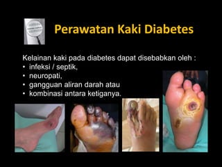 Komplikasi dm by dr gabriella | PPTX