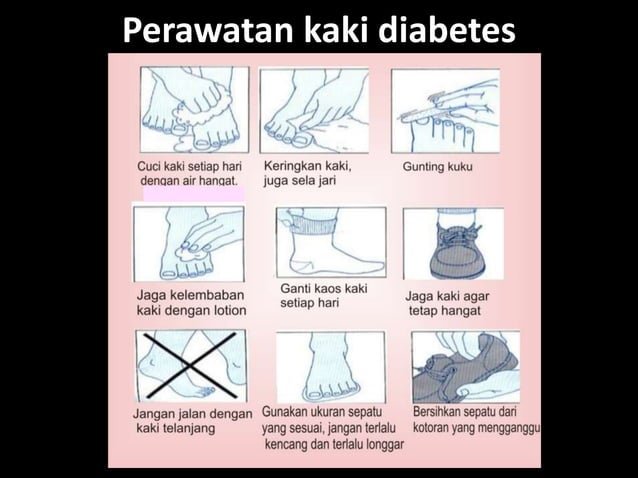 Komplikasi dm by dr gabriella | PPTX