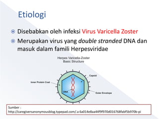 Komplikasi oral dari infeksi herpes zoster | PPTX