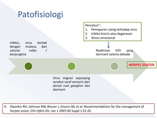 Komplikasi oral dari infeksi herpes zoster | PPTX