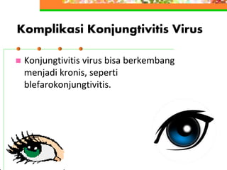 Komplikasi & prognosis Konjungtivitis Virus | PPTX