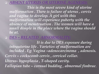 Uterine malformation | PPTX