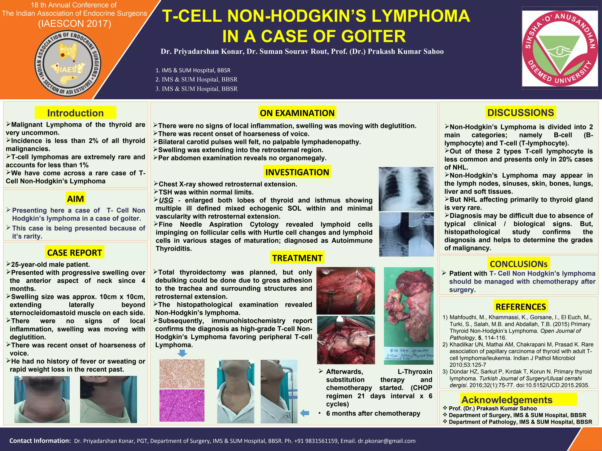 T-cell non Hodgkin's lymphoma in a case of goiter - e poster | PPT