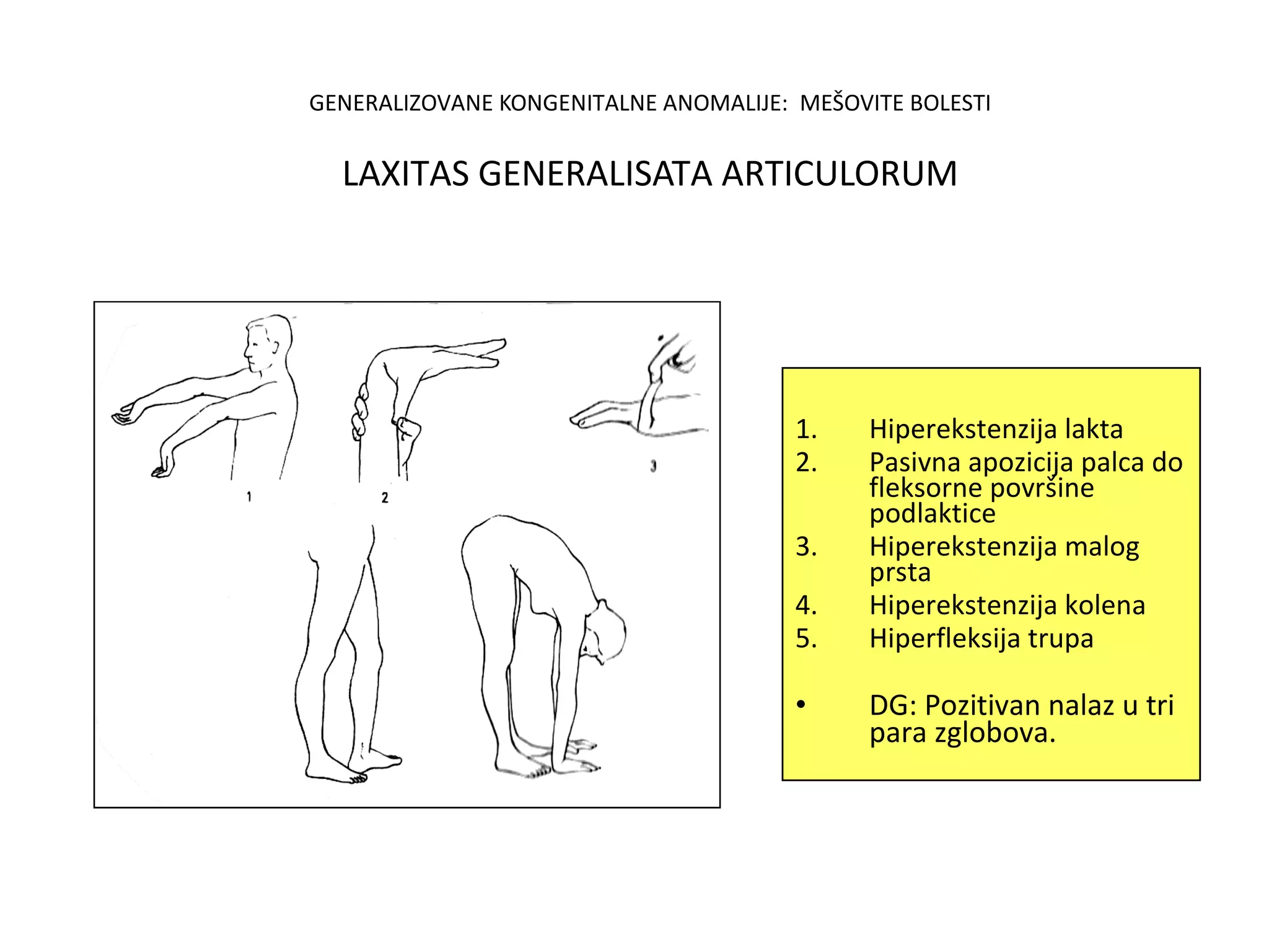 Kongenitalne i razvojne anomalije ekstremiteta | PPT