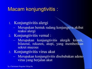 Konjungtivitis | PPT