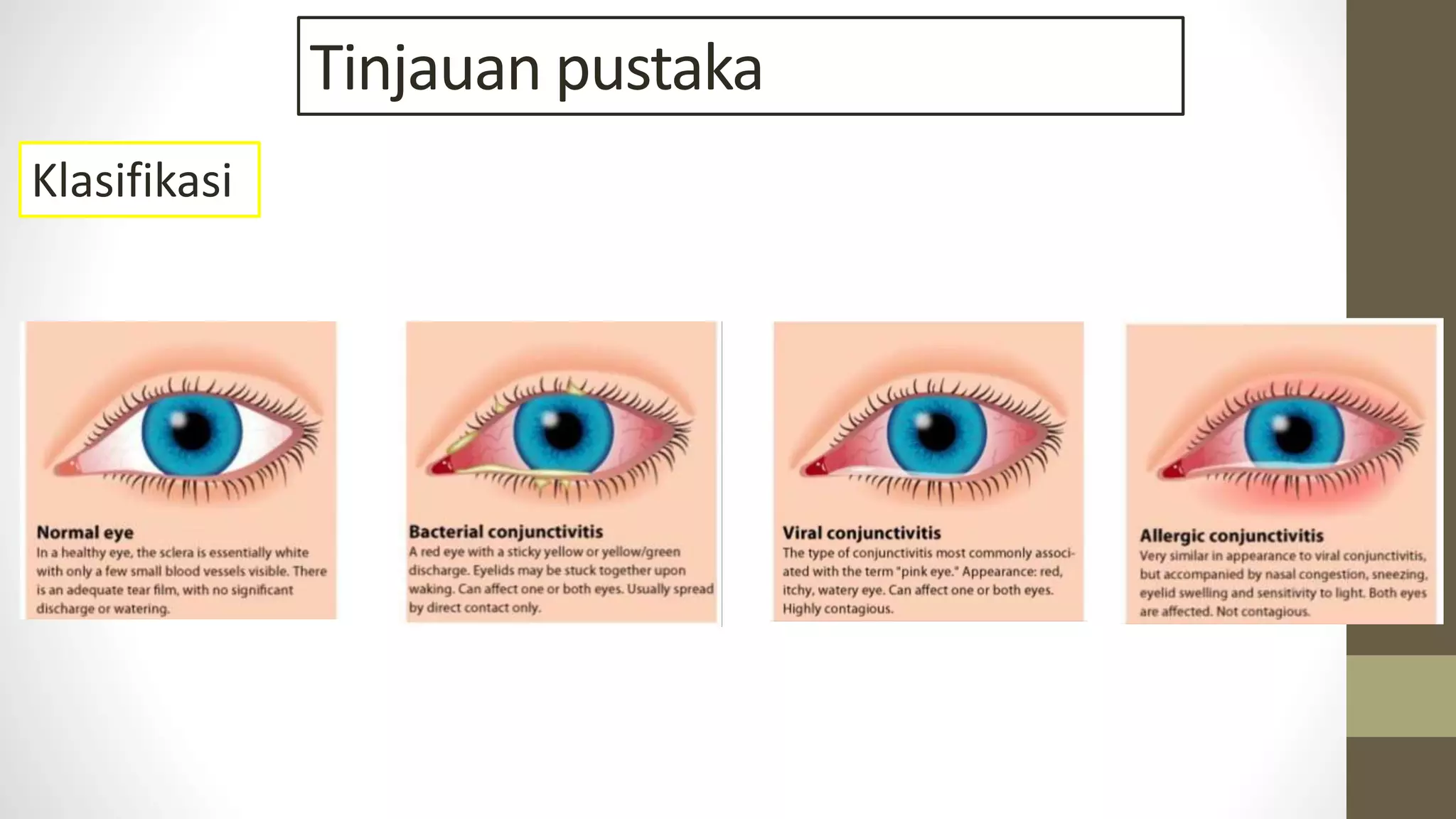 Konjungtivitis.pptx
