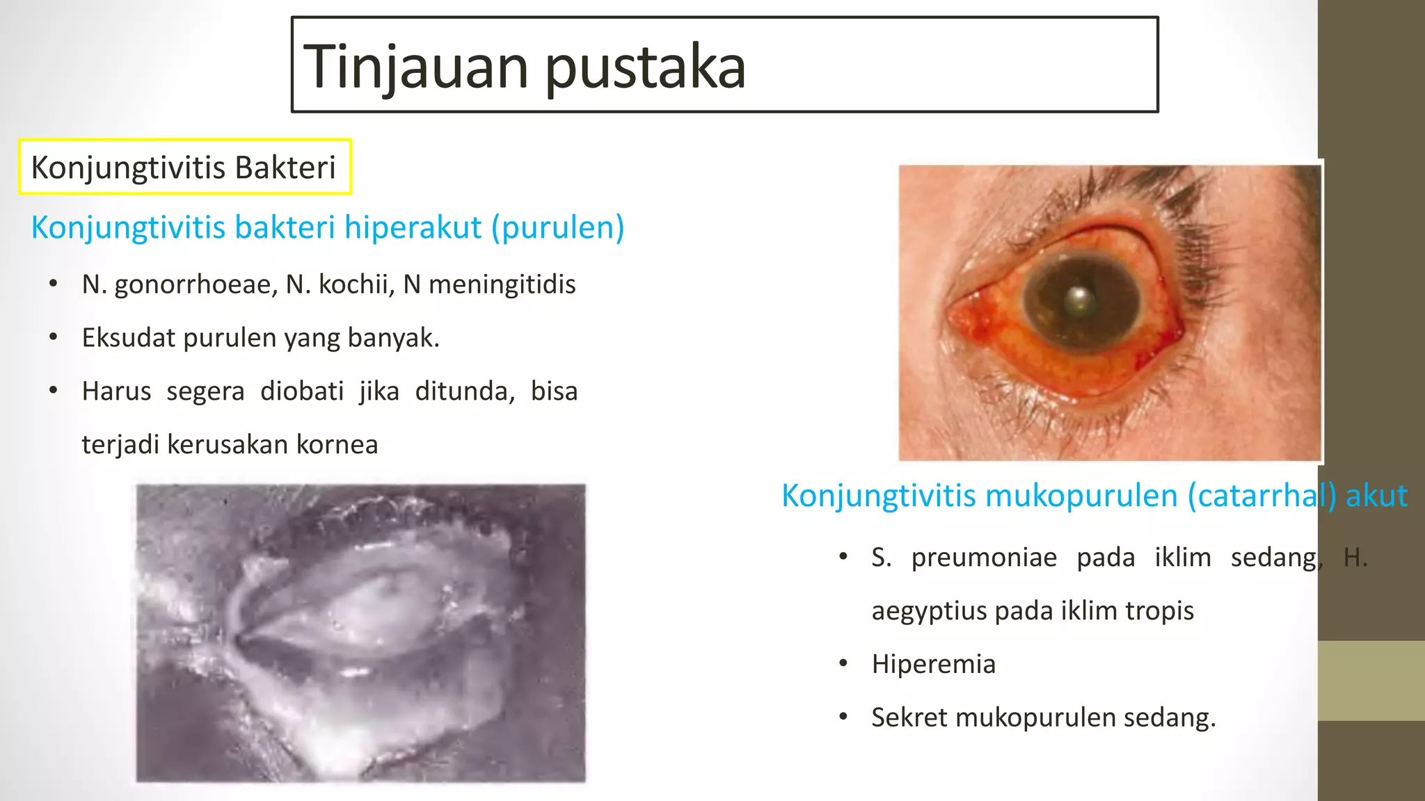 Konjungtivitis.pptx