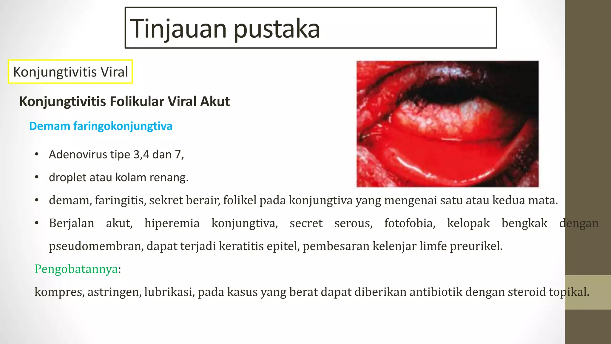 Konjungtivitis.pptx