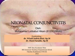 Conjungtivitis Neonatorum /Neonatal.pptx
