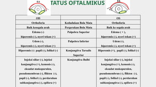 KONJUNGTIVITIS VIRAL PRESENTASI STASE MATA | PPTX