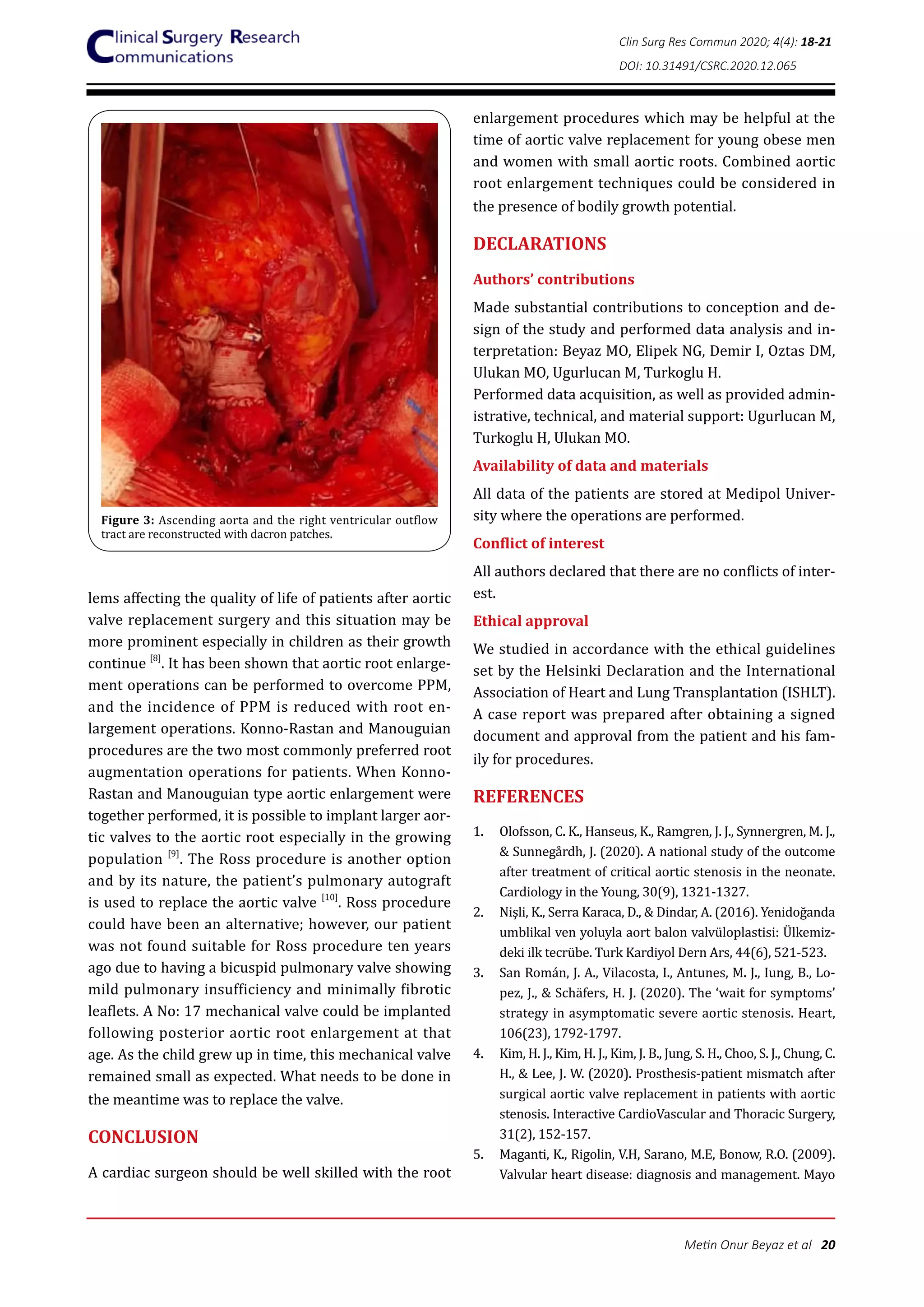 Konno rastan procedure combined with manougian root enlargement for ...