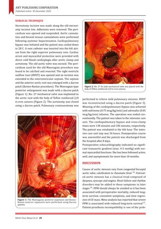 Konno rastan procedure combined with manougian root enlargement for ...