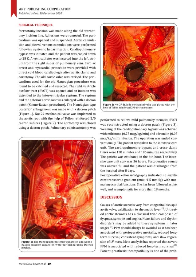 Konno rastan procedure combined with manougian root enlargement for ...