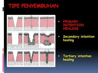 konsep-dasar-luka.ppt