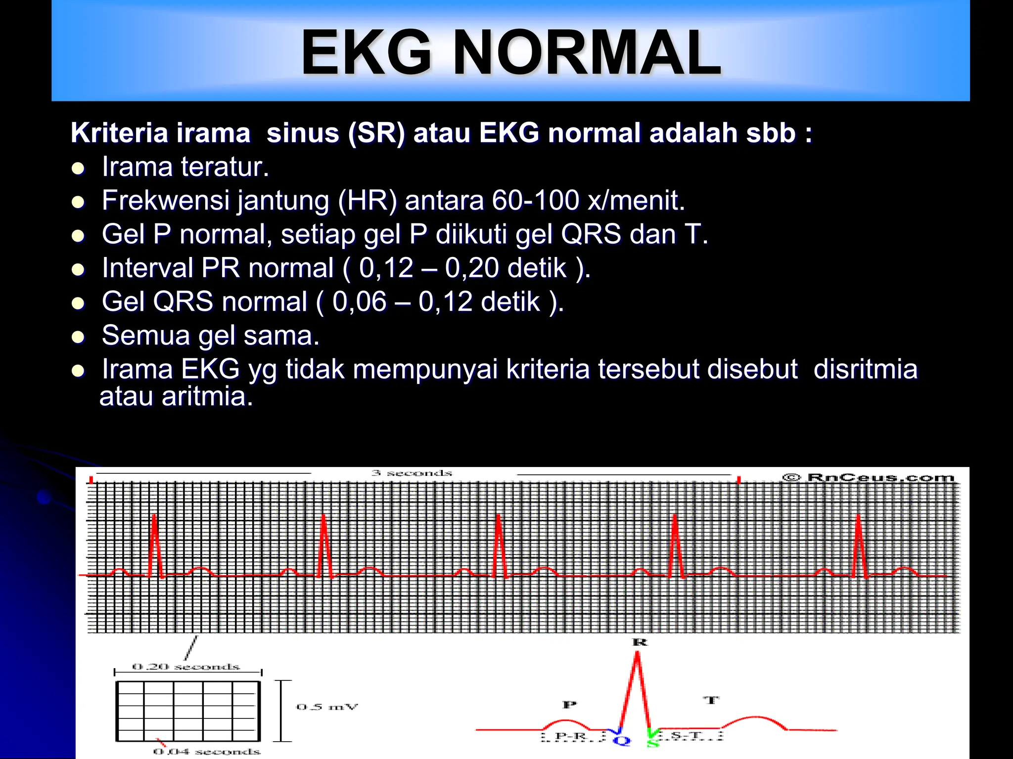 konsep dasar ekg.ppt
