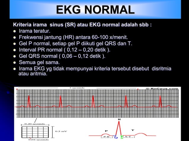 konsep dasar ekg.ppt