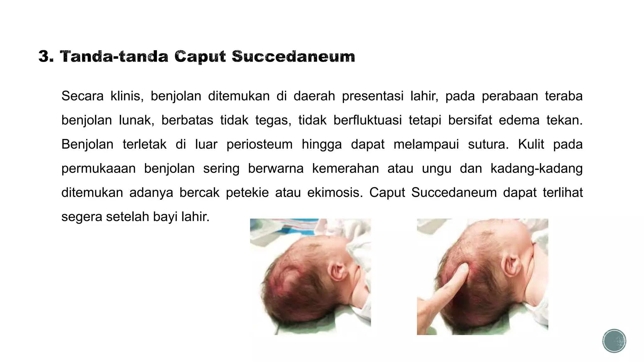 Konsep dasar neonatus dengan jejas persalinan | PPTX