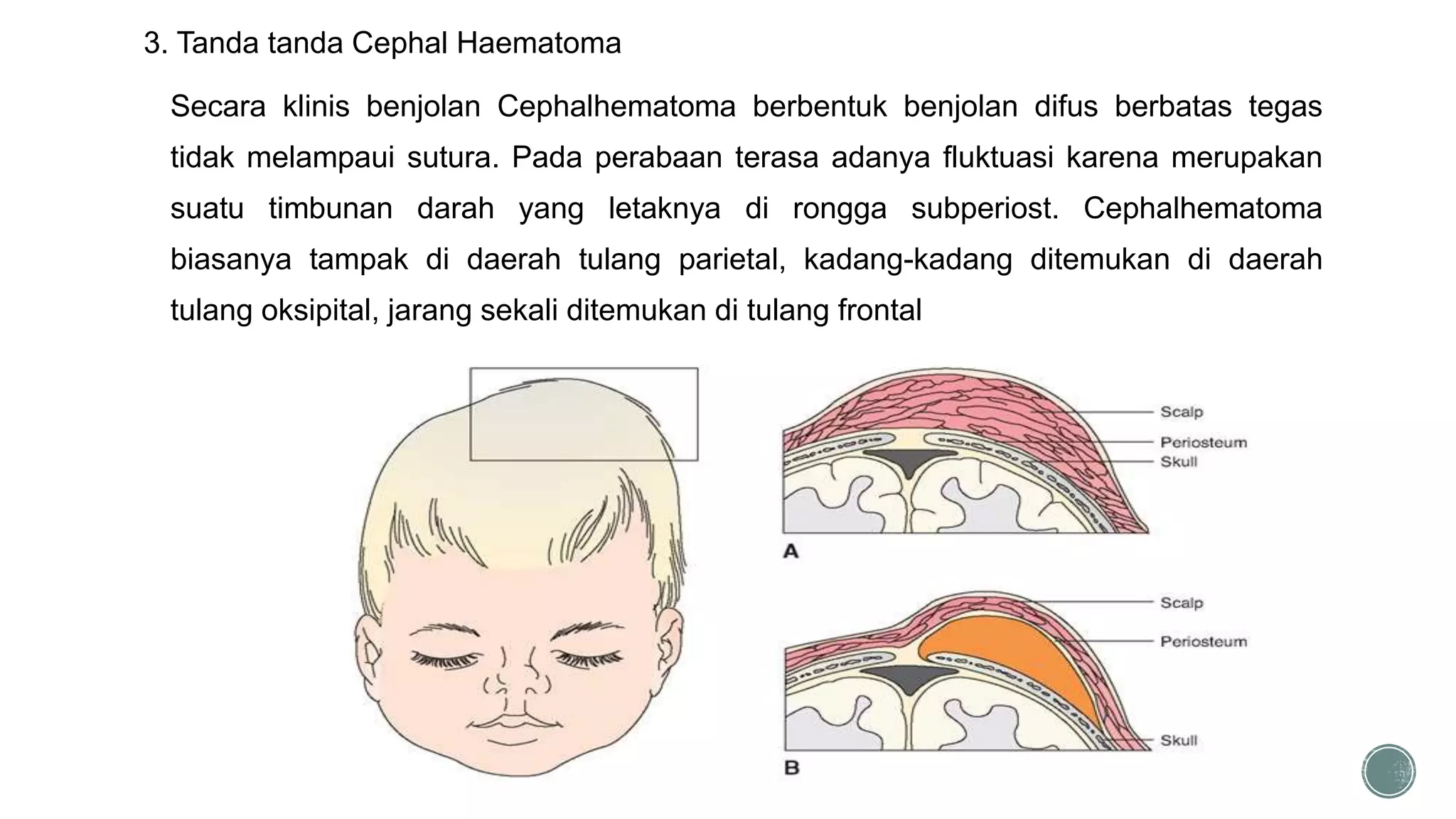 Konsep dasar neonatus dengan jejas persalinan | PPTX