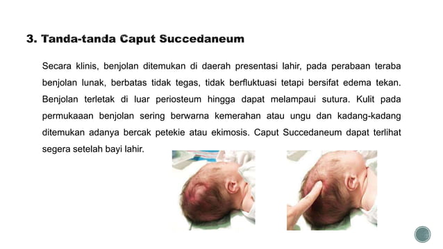 Konsep dasar neonatus dengan jejas persalinan | PPTX