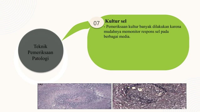 Konsep dasar patologi dan patofisiologi.pptx