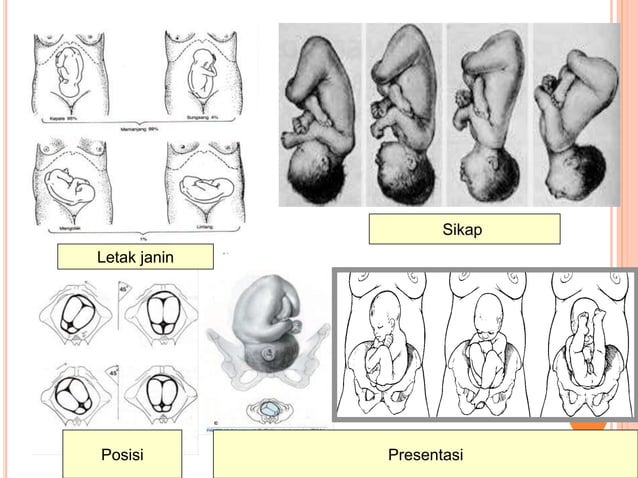 Konsep konsep Dasar persalinan Normal.ppt