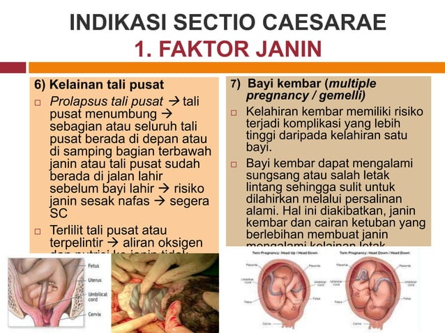 Konsep Dasar Sectio Caesarea | PPTX