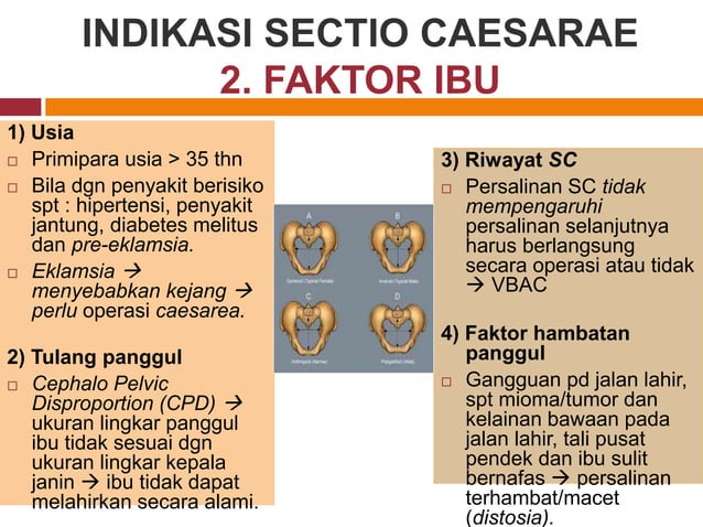 Konsep Dasar Sectio Caesarea | PPTX