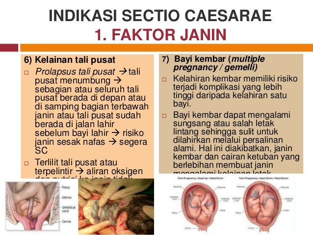 Konsep Dasar Sectio Caesarea