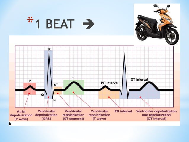 basic concept of Electrocardiography for nurse | PPT