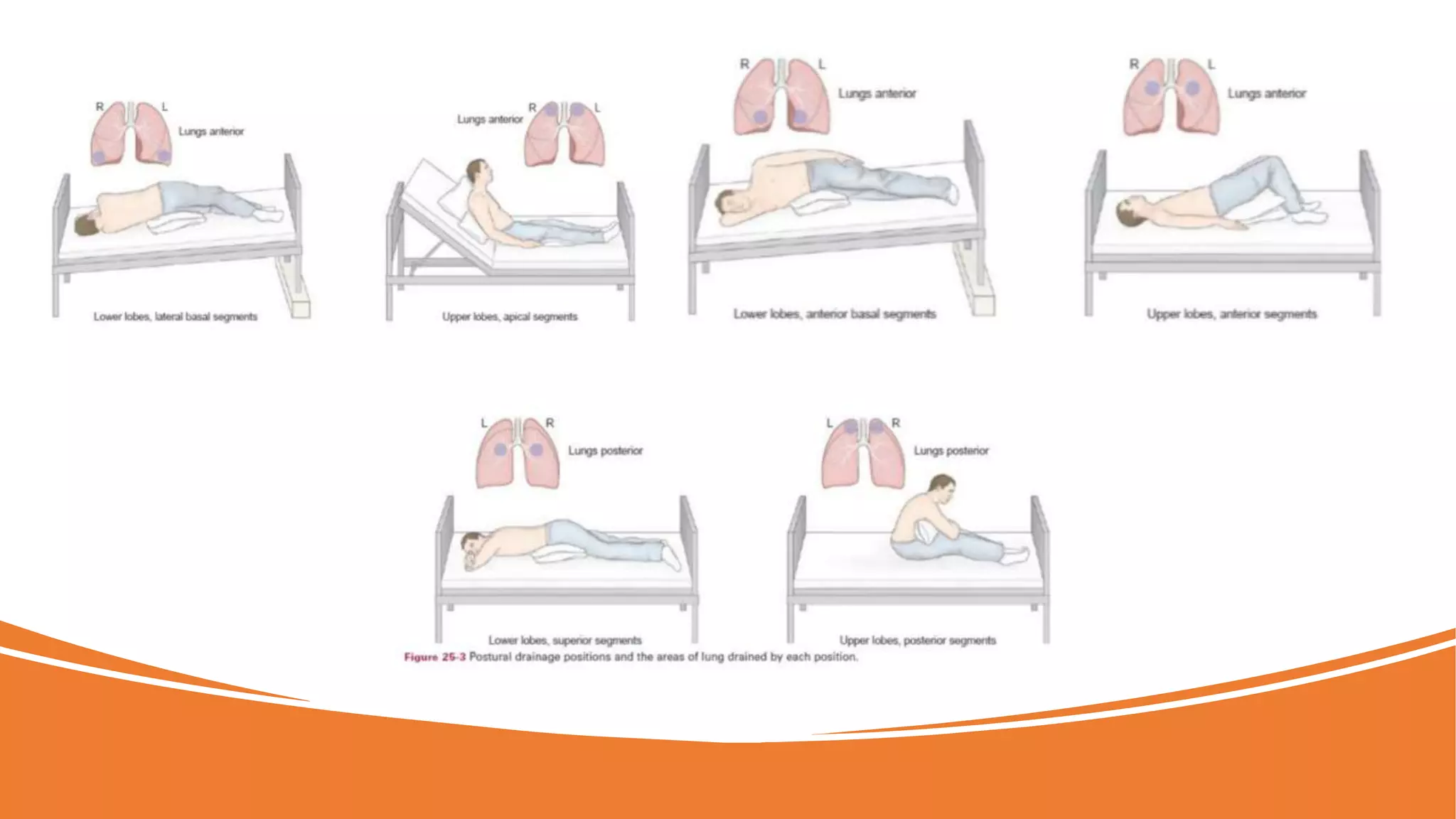 Fisioterapi Dada.pptx