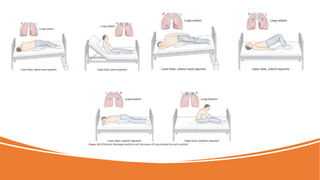 Fisioterapi Dada.pptx